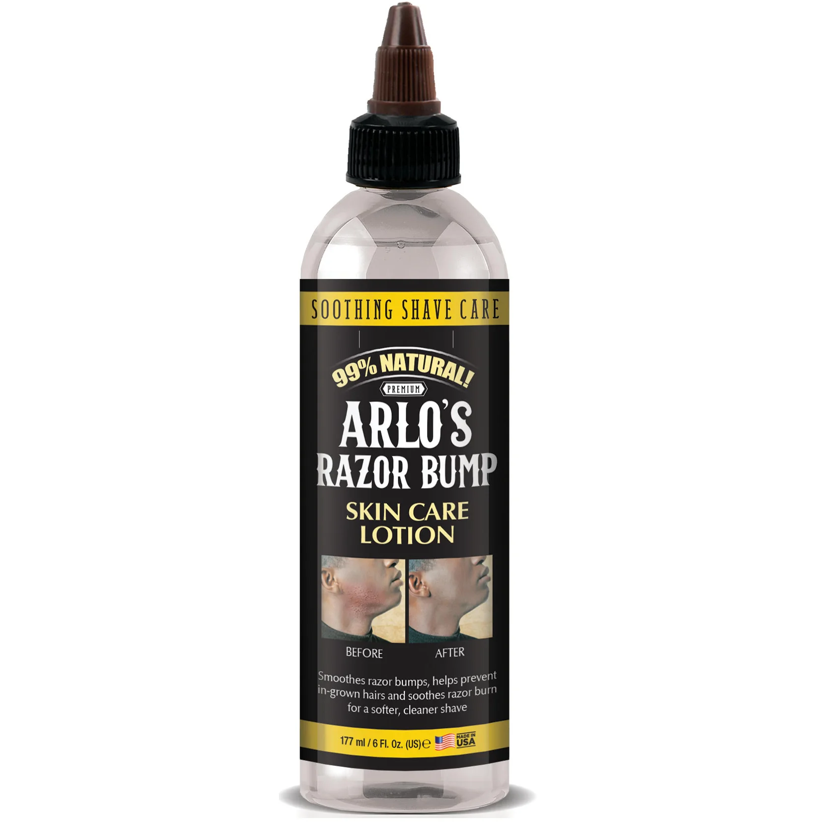 Arlo's Razor Bump Lotion 4oz - Janson Beauty